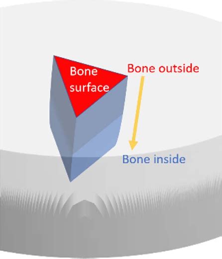 Figure 1 From An Automated Fracture Detection From Pelvic Ct Images With 3 D Convolutional