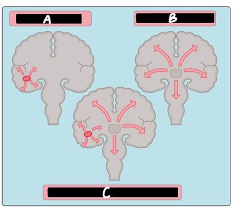 Functional Localisation Flashcards Quizlet