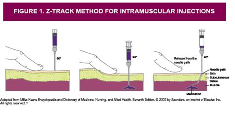 Best Practices For Im Injection Of Fulvestrant Oncology Nursing Society