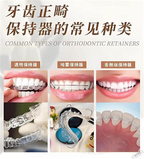 牙齿正畸保持器种类全解析：如何选择适合自己的保持器 佑牙医生