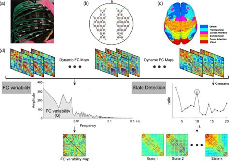 Abnormal Dynamic Functional Connectivity And Brain States In Alzheimers Diseases Functional