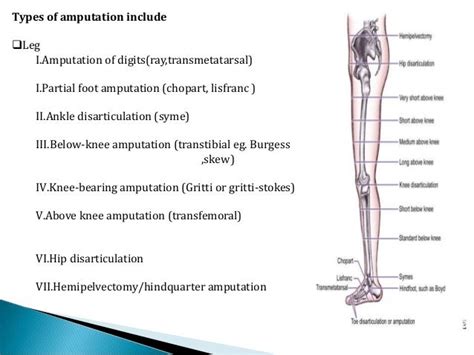 Below Knee Amputation Anatomy