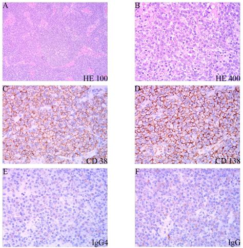 A At Low Magnification The Lymphatic Sinuses Are Open The Lymphatic Download Scientific