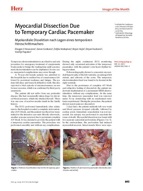 Pdf Myocardial Dissection Due To Temporary Cardiac Pacemaker