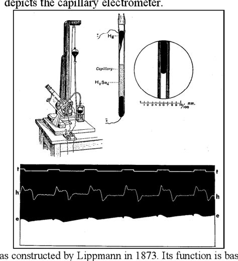 Figure 1 From A Brief History Of Electrocardiography Semantic Scholar