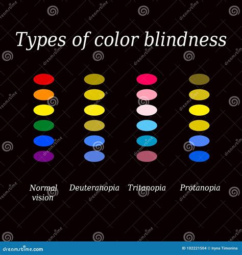 Types Of Color Blindness Eye Color Perception Stock Vector