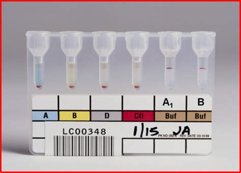 Blood Bank Lecture 1 Gel And Solid Phase Testing Flashcards Quizlet