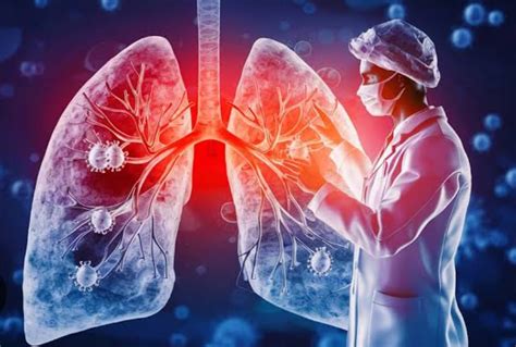 Certificate Course In Respiratory Medicine Pulmonology Medway