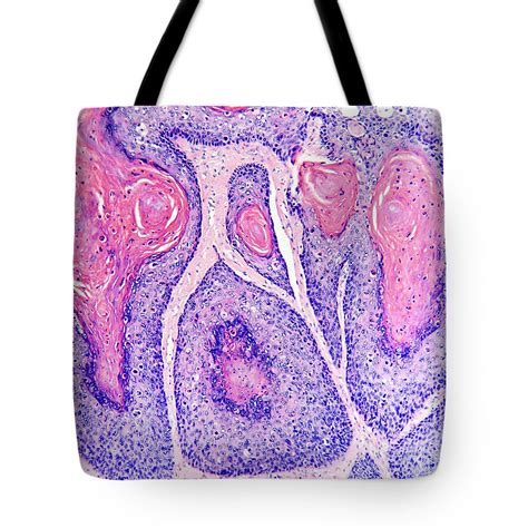Microscope Tote Bags For Sale By Science Source Prints
