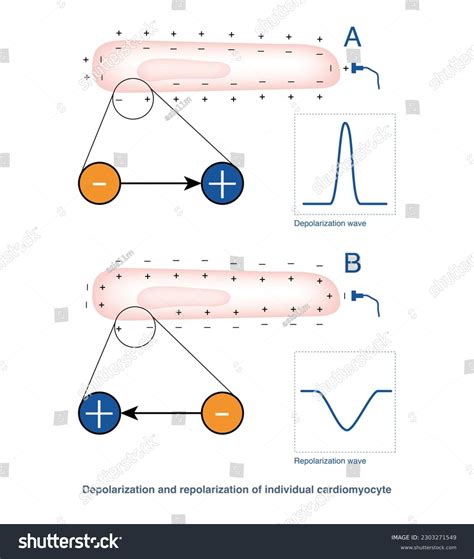 Depolarization