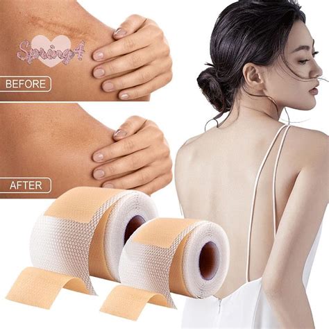 ซิลิโคนรอยแผลเป็น Patch Nude Scar Tape Roll Scar Sheet Removal Self