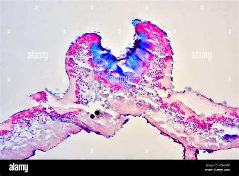 Lichens Under Microscope
