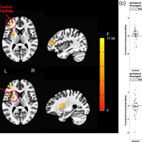Results Of The Visuomotor‐dependent Connectivity Analysis Corrected