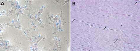 A Feridex Labeled Tenocytes Before Injection Stained With Prussian