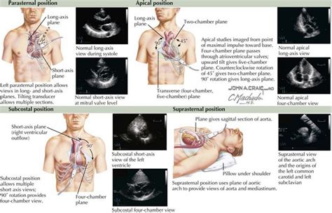 Echocardiography Thoracic Key
