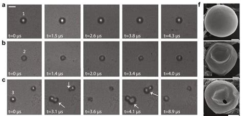 1 A B And C Microbubbles Under Microscope Reveals Three Different