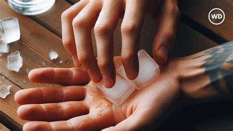 क्या आप भी करते हैं जली हुई जगह पर बर्फ या टूथपेस्ट लगाने की गलती जान