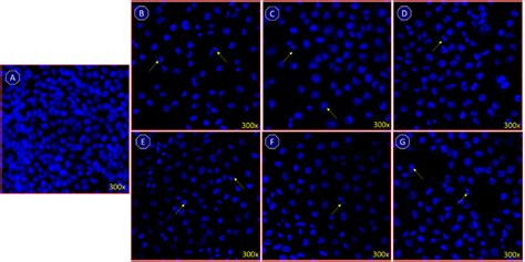 DAPI Stainings Shows The Impact Of A Control B Download Scientific Diagram