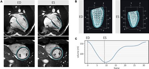 Frontiers Mitea A Dataset For Machine Learning Segmentation Of The Left Ventricle In 3d