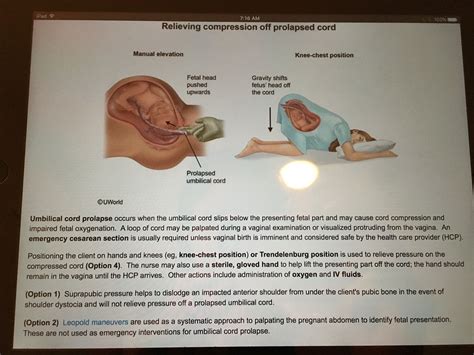 Knee Chest Position For Prolapsed Cord