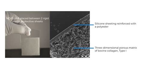 Nevelia Dermal Regeneration Template By Symatese