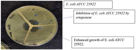 Comparison Of Three Phenotypic Methods Of Carbapenemase Enzyme