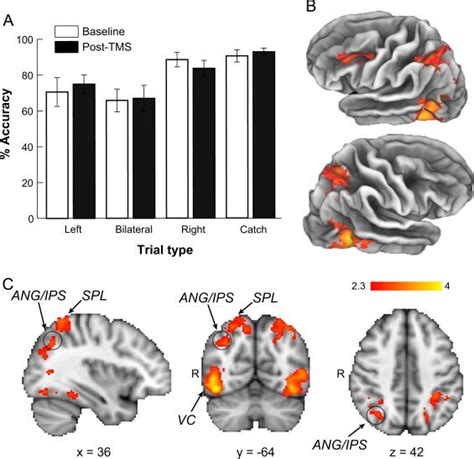 Cortical Network Activated During Bilateral Attention Experiment 2 Download Scientific