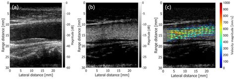 Two Dimensional Wavenumber Analysis Implemented In Ultrasonic Vector
