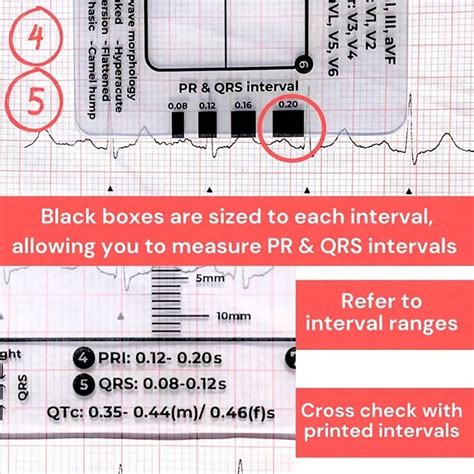Acrylic Medical Ruler 7 Step Diagnostic Guide Waveform Measurement Tool For Cardiac Reading