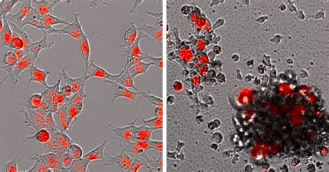 Agilent Cell Analysis On Linkedin Cellanalysis Xcelligence Esight Novocyte Celltherapy…