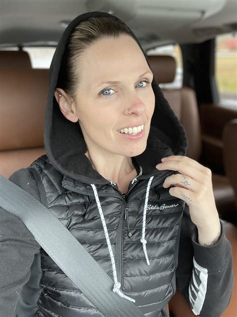 I Got A Zit On My Face But Dont Call Me Zit Face Scrolller