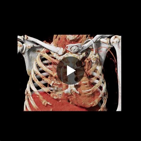 Anatomical Features In 3d Imaging Unusual Stanford 3d And Quantitative Imaging Laboratory