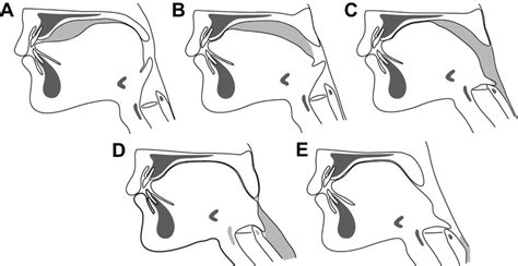 Deglutition Phase Pharyngeal Phases Voluntary Esophageal Anatomy