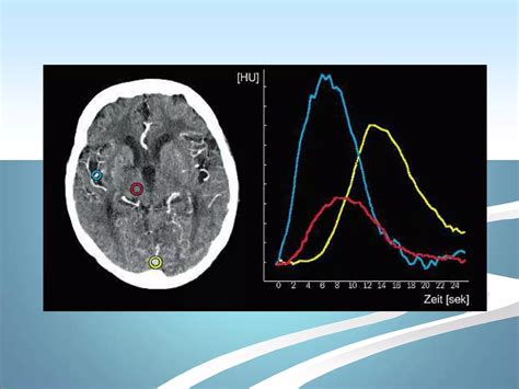 Imaging In Stroke Pptx
