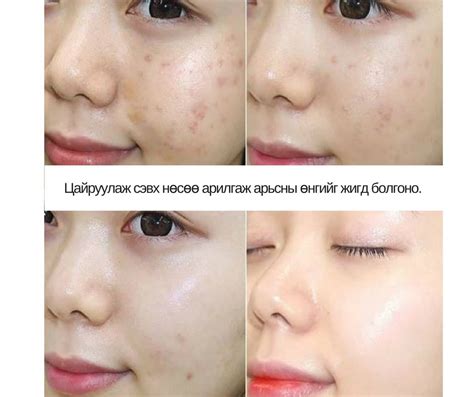 Wettrust Store Түрхдэг Ботокс гэж юу вэ🤔 Мэс