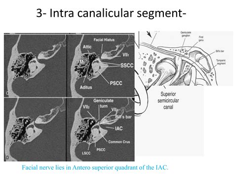 Facial Nerve Anatomy And Important Aspects Pptx