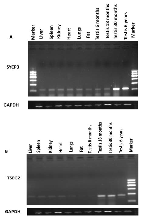 Molecular Cloning And Characterization Of Sycp3 And Tseg2 Genes In The