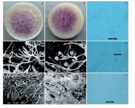 Colony Characteristics And Spore Development And Shape Are Used To