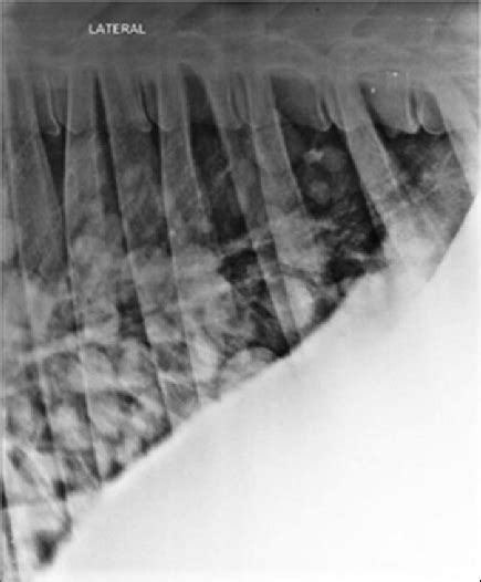 Lateral Radiograph Of Chest Showing Severe Diffuse Nodular Interstitial Download Scientific
