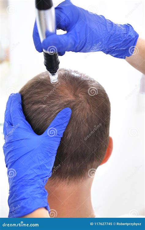 Needle Mesotherapy Of The Scalp Stock Image Image Of Analysis Bald 117627745