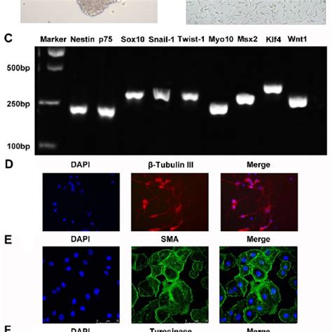 Neural Crest Origin And Pluripotency Of Differentiation Of Ncscs A