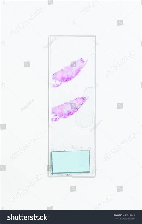 Heterogenous Thyroid Gland Photos And Images Shutterstock
