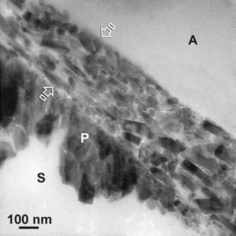 Etched Enamel Structure And Topography Interface With Materials Pocket Dentistry