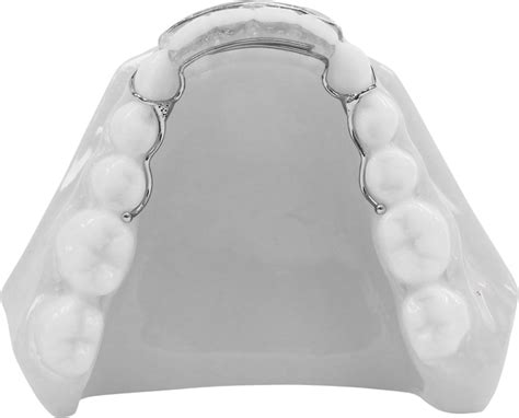 Retainers Ricoh Orthodontic Appliances