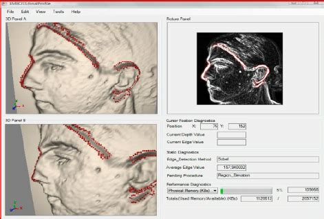 Edge Detection By Sobel Technique Download Scientific Diagram