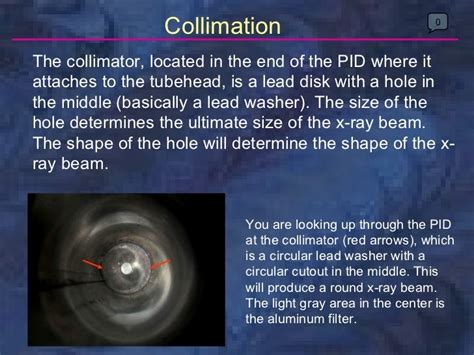 Radiology X Ray Production