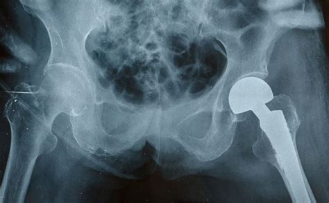 Post Recall Preparedness How Practices Are Screening And Managing