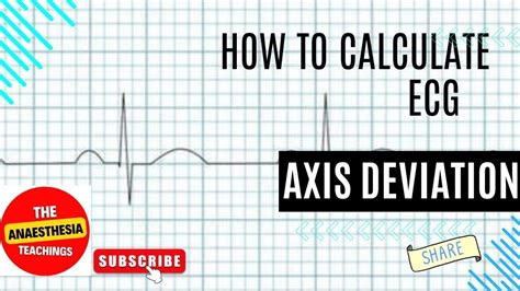 Leaked A Very Easy Way To Calculate Axis Determination In Ecg