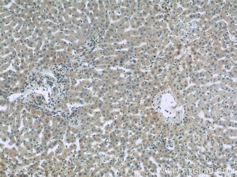 Complement Factor B Antibody 10170 1 Ap Complement Factor B Antibody 10170 1 Ap