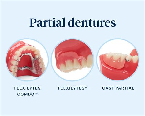 Benefits Of Upper And Lower Partial Dentures Aspen Dental